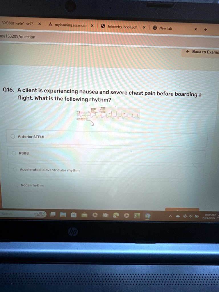 q16 a client is experiencing nausea and severe chest pain before ...