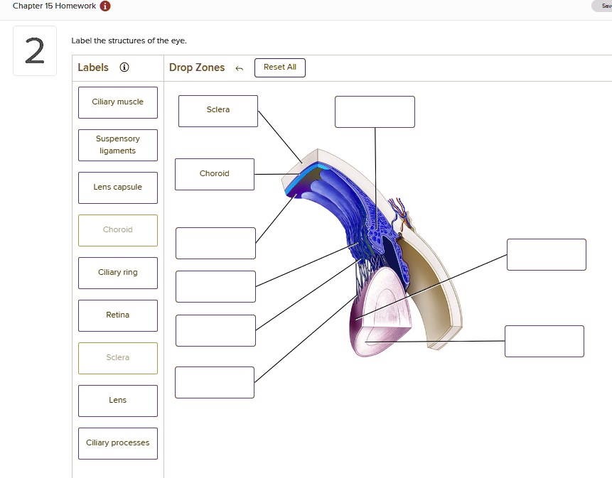 SOLVED: Chapter 15 Homework Label the structures of the eye. 2 Labels ...