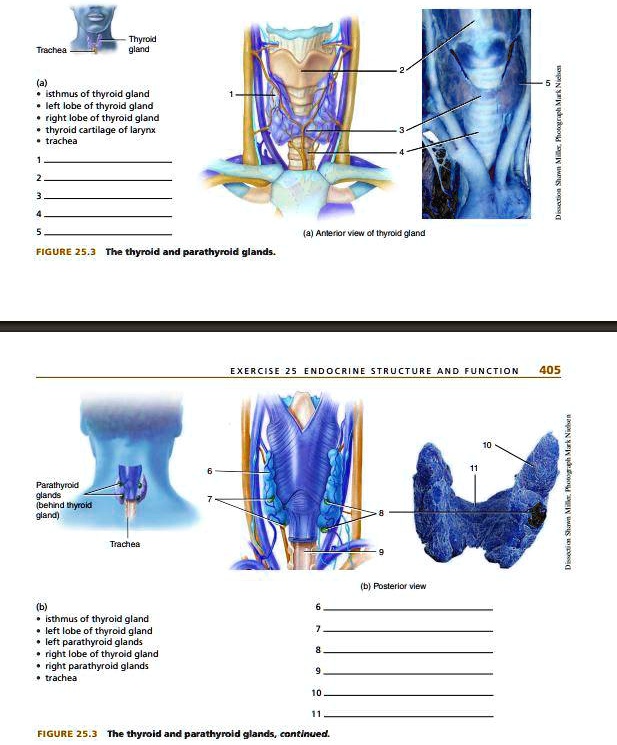 Trachea Thyroid gland 2 (a) • isthmus of thyroid gland • left lobe of ...