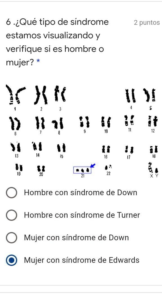 SOLVED: ayudenmeeee Porfavooooor! 6 ' Qué tipo de síndrome estamos ... SOLVED: ayudenmeeee Porfavooooor! 6 ' Qué tipo de síndrome estamos ...