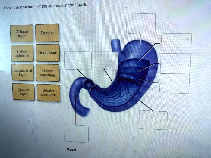 SOLVED: Label the structures of the stomach in the fiqure Oblique layer Fundus Pyloric sphincter ...