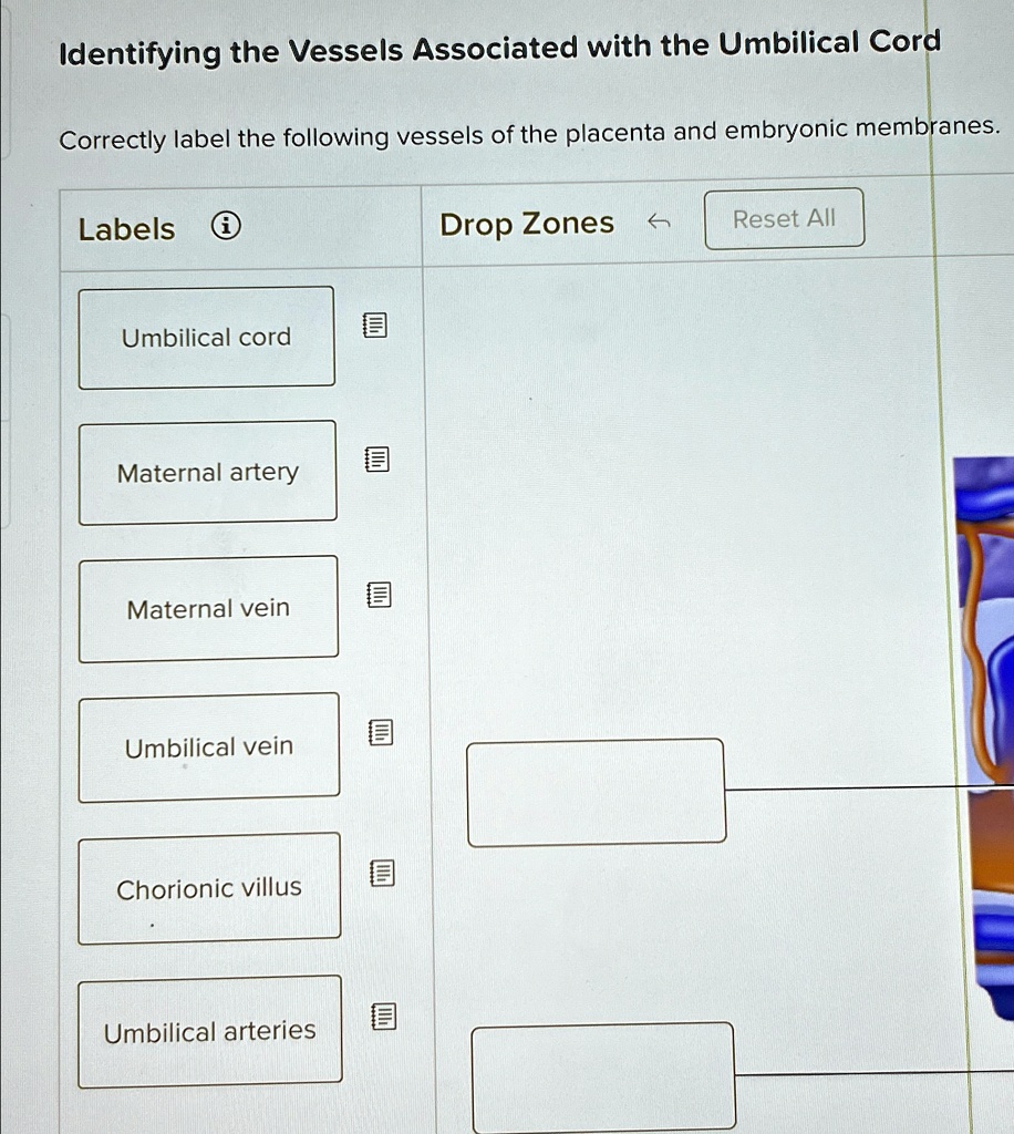 Identifying the Vessels Associated with the Umbilical Cord Correctly ...