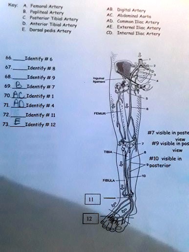 Key: A. Femoral Artery B. Popliteal Artery C. Posterior Tibial Artery D ...