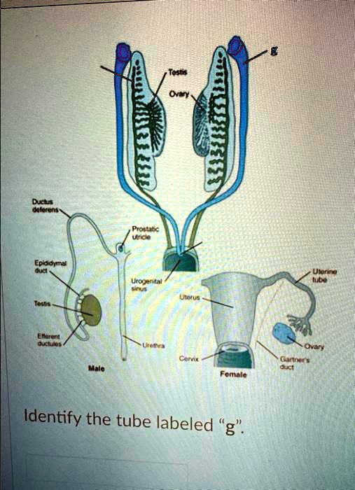 SOLVED: Prostatic utricle Urogenital sinus Tube Uterus Cervix Gartner's ...