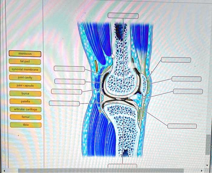 SOLVED: Meniscus Fat pad Synovial membrane Joint cavity Joint capsule ...