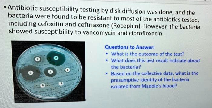 antibiotic susceptibility testing by disk diffusion was done and the ...