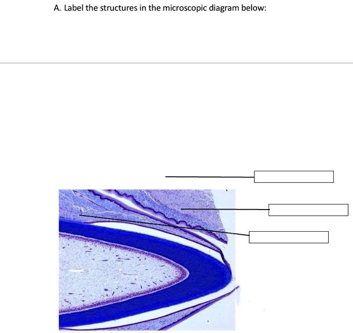 SOLVED: A Label the structures in the microscopic diagram below: SOLVED: A Label the structures in the microscopic diagram below: