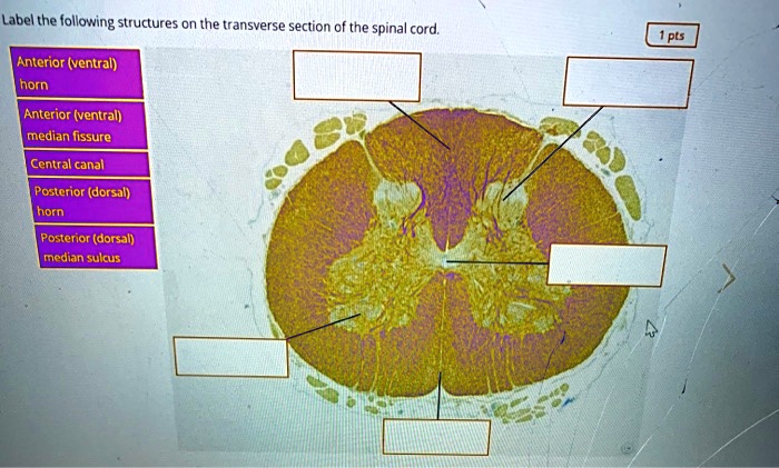 SOLVED: Label the following structures on the transverse section of the ...