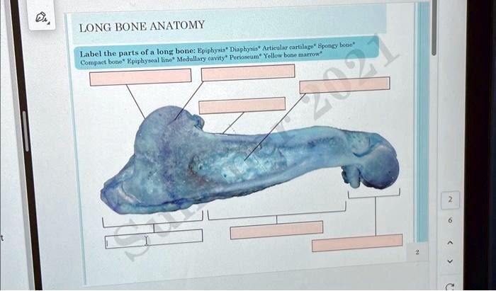 SOLVED: Text: LONG BONE ANATOMY Label the parts of a long bone ...