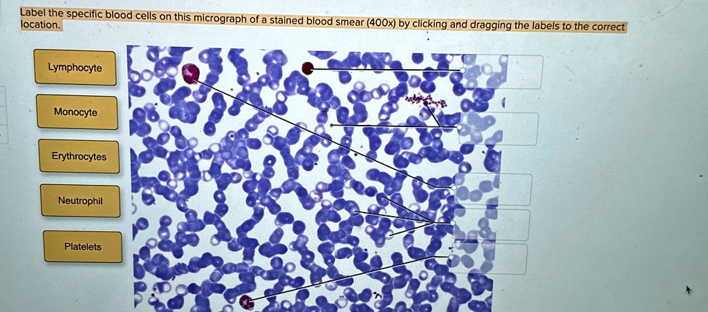 Label the specific blood cells on this micrograph of a stained blood ...
