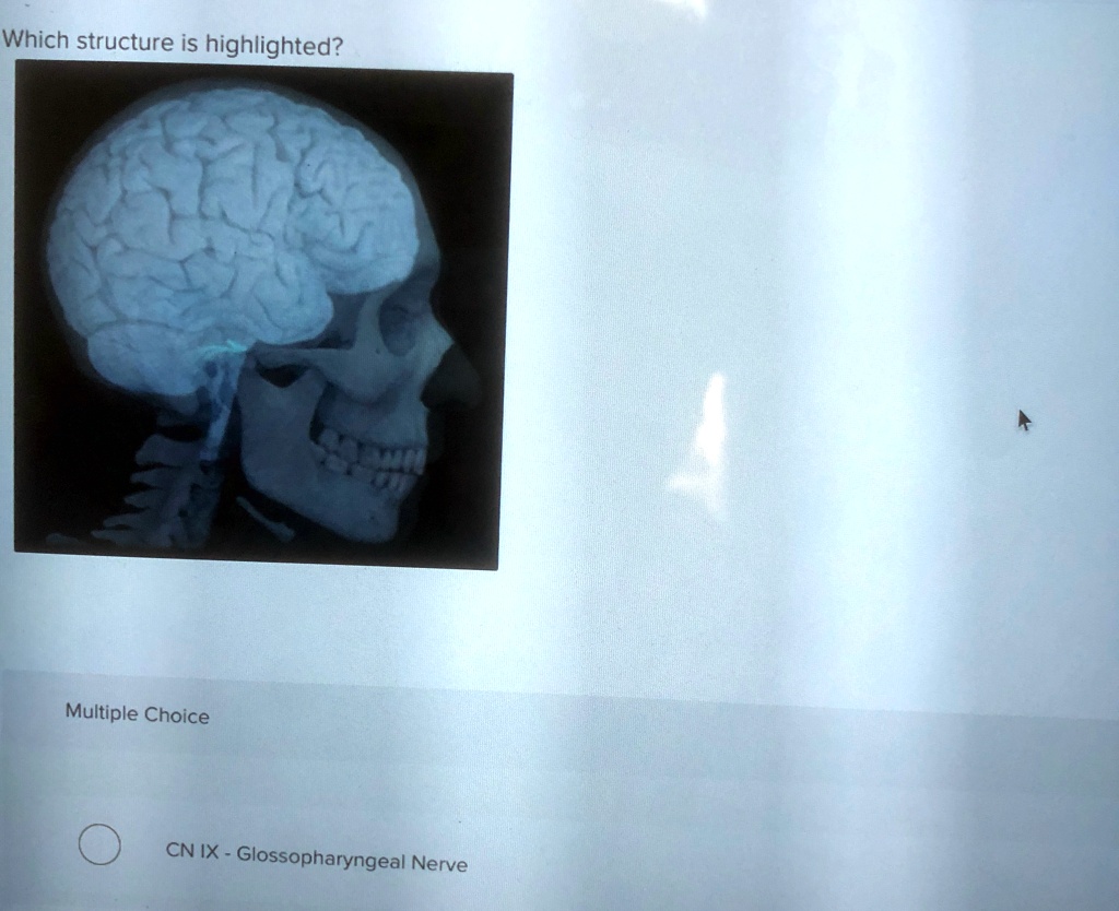 Which structure is highlighted? Multiple Choice CN IX ...