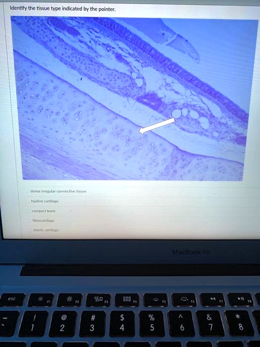 SOLVED: Identify the tissue type Indicated by the pointer: mr4j (uILLa F Manaan comouctbor Fa[n 30