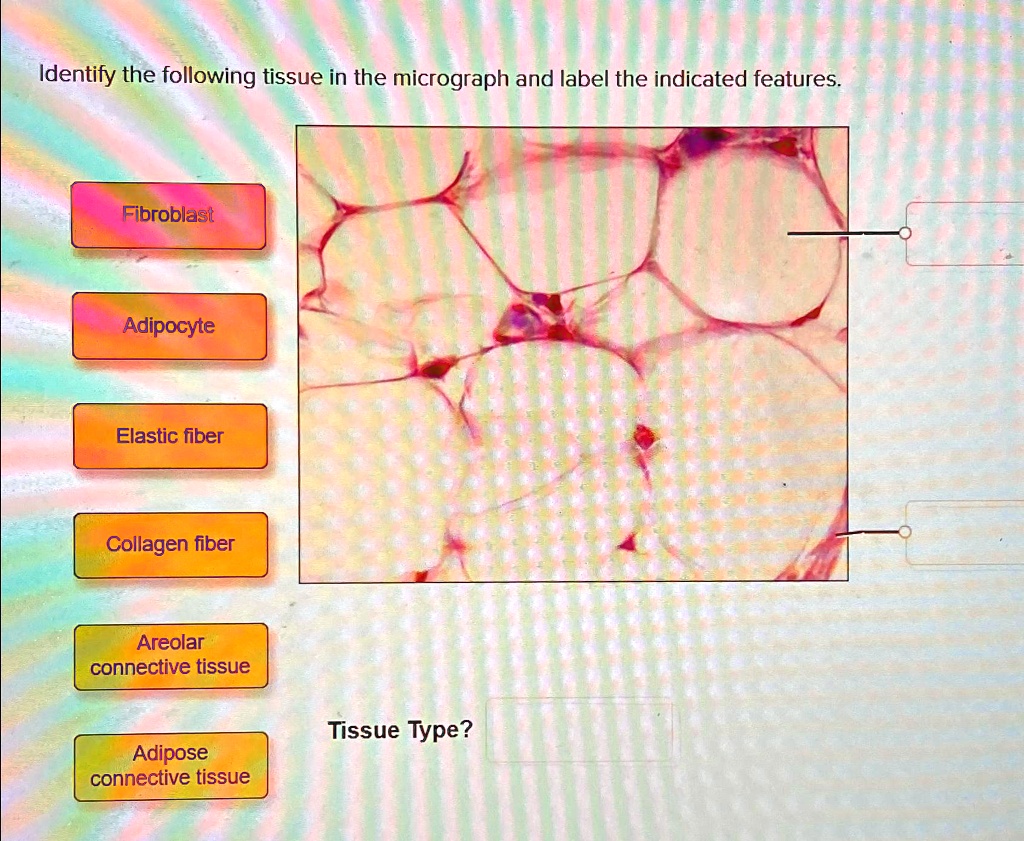 [GET ANSWER] Identify the following tissue in the micrograph and label the indicated features ...