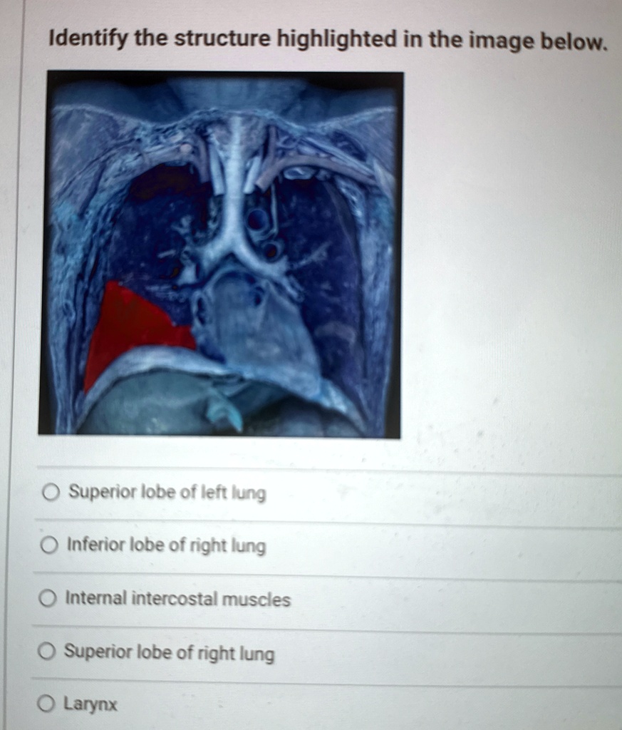 Identify the structure highlighted in the image below. Superior lobe of ...