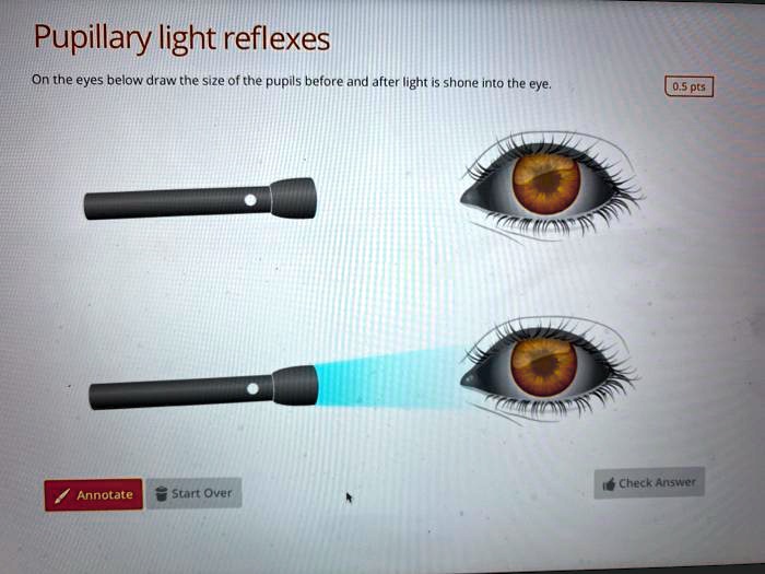 pupillary light reflexes on the eyes below drawthe size of the pupils ...