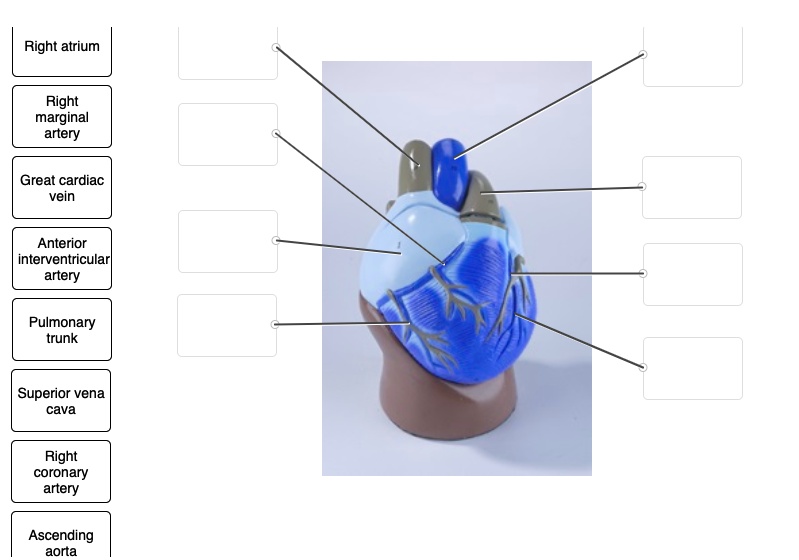 Right atrium Right marginal artery Great cardiac vein Anterior ...
