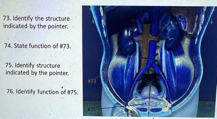 SOLVED: 73. Identify the structure indicated by the pointer: 74, State ... SOLVED: 73. Identify the structure indicated by the pointer: 74, State ...