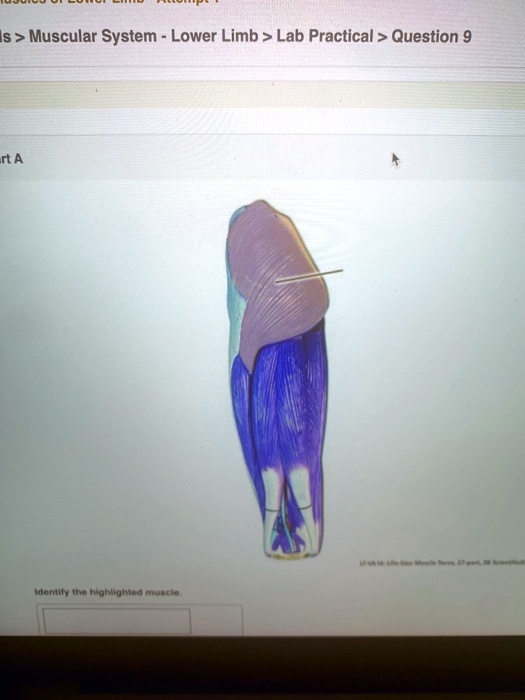 Muscular System - Lower Limb - Lab Practical - Question 9 Identify the ...