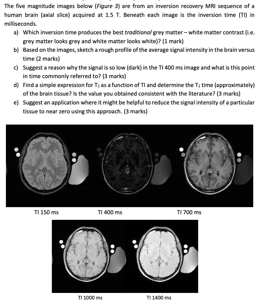 SOLVED: The five magnitude images below (Figure 3) are from an ...