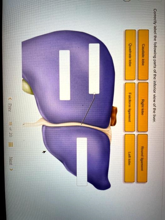 SOLVED: Quadrate lobe Caudate lobe Correctly label the following parts ...
