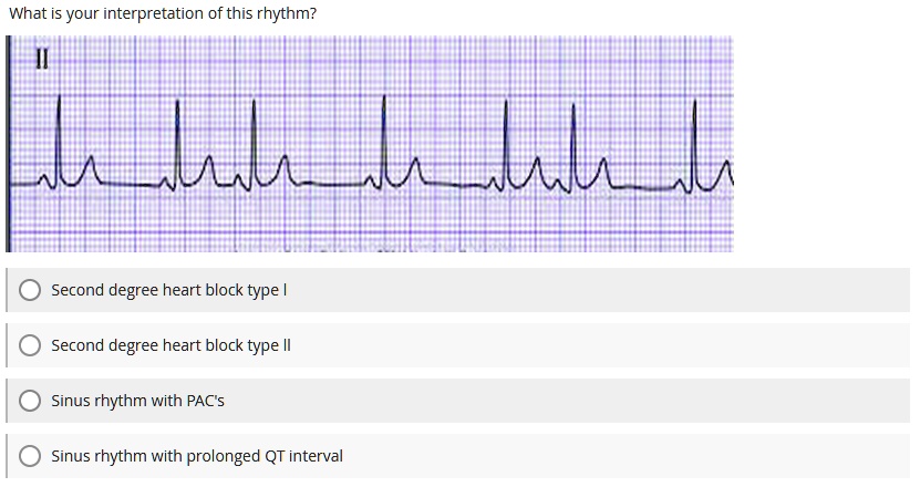 SOLVED: What is your interpretation of this rhythm? Second degree heart ... SOLVED: What is your interpretation of this rhythm? Second degree heart ...