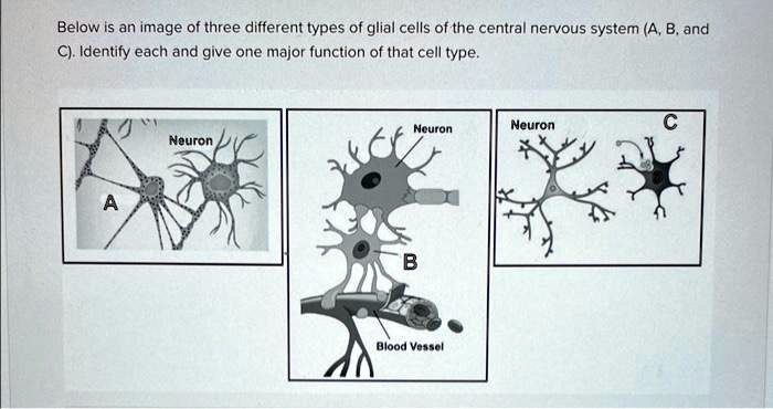 SOLVED: Below is an image of three different types of glial cells of ...