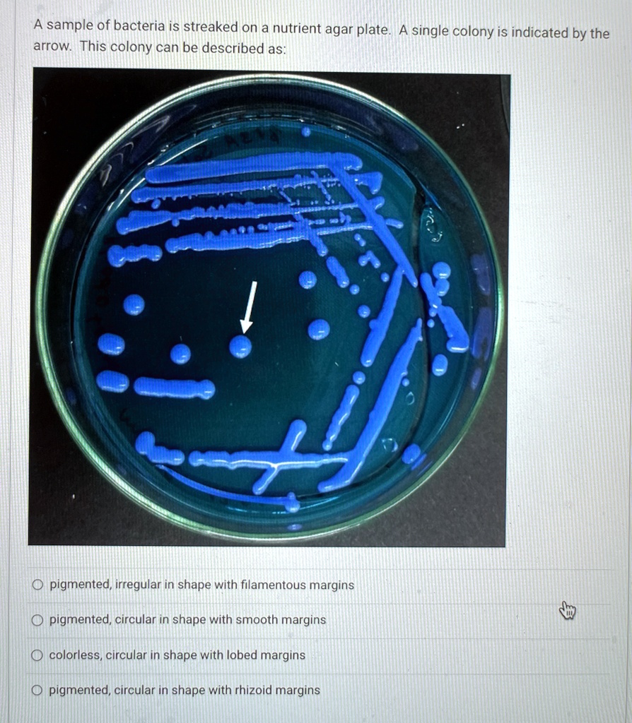 A sample of bacteria is streaked on a nutrient agar plate. A single ...