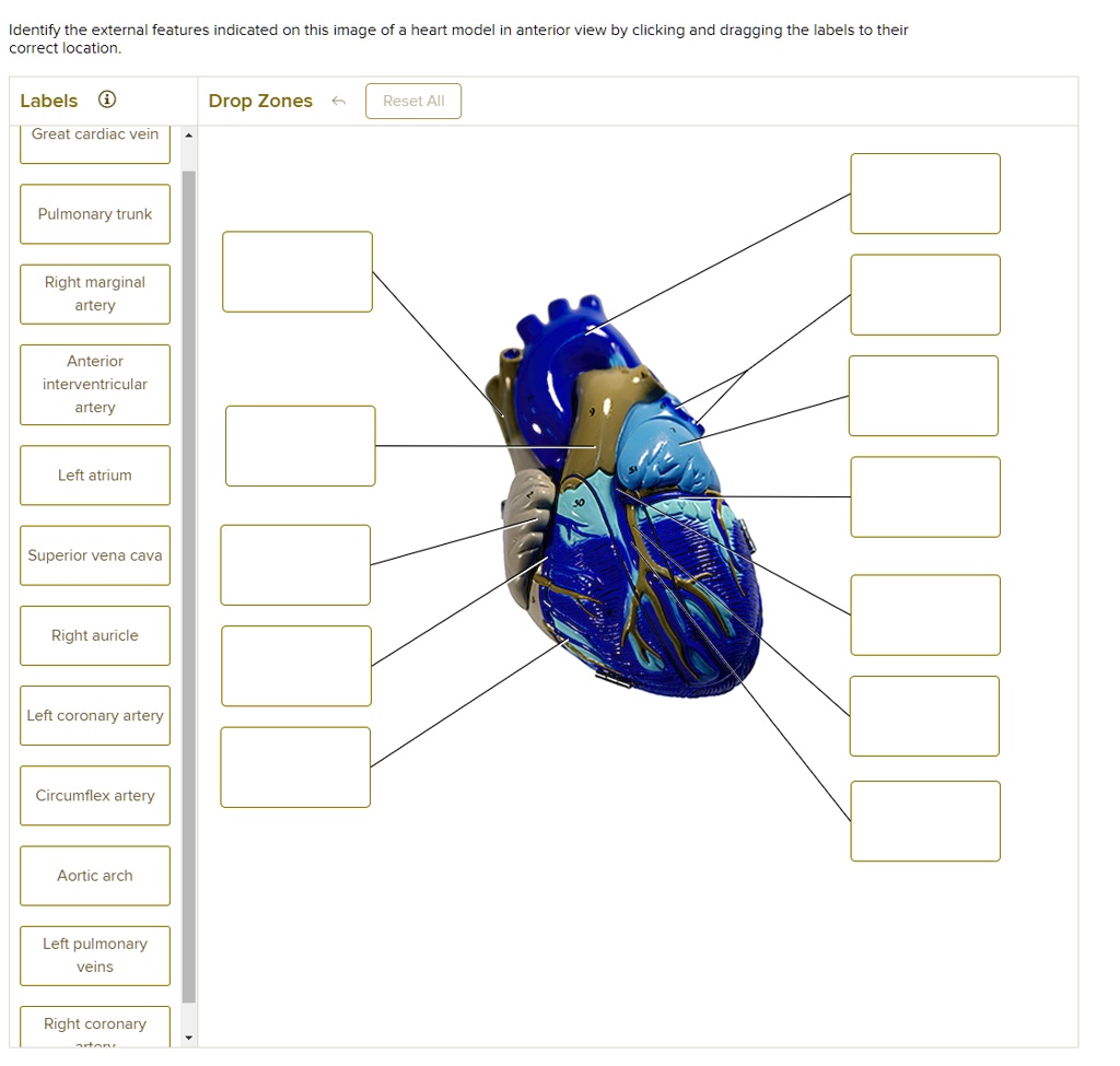 SOLVED: artery Inferior vena cava Right ventricle Left ventricle Right atrium Aortic valve ...