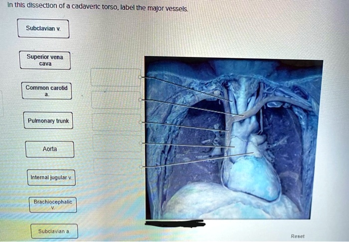 [GET ANSWER] In this dissection of a cadaveric torso, label the major ...