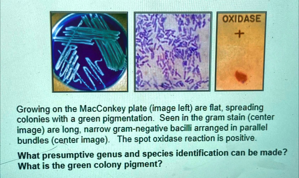 Growing on the MacConkey plate (image left) are flat, spreading ...