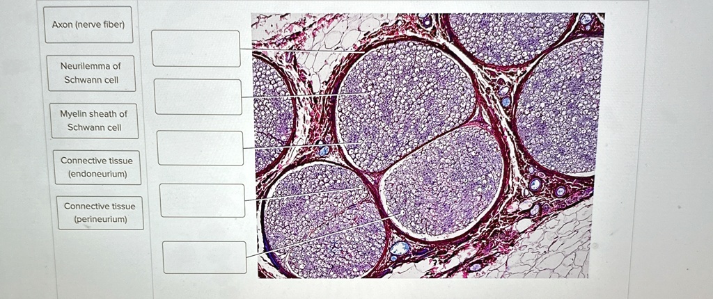 axon nerve fiber neurilemma of schwann cell myelin sheath of schwann ...