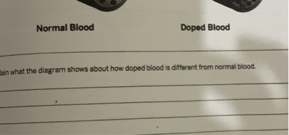 Normal Blood Doped Blood lain what the diagram shows about how doped ...