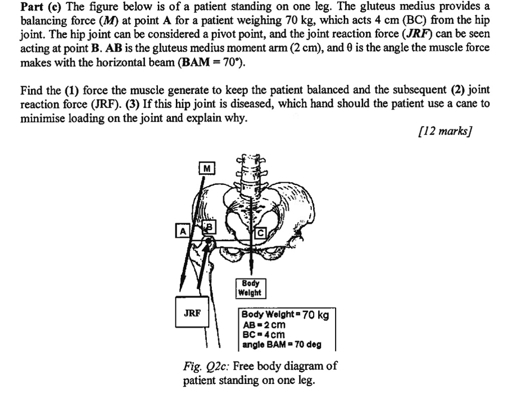 Part (c) The figure below is of a patient standing on one leg. The ...