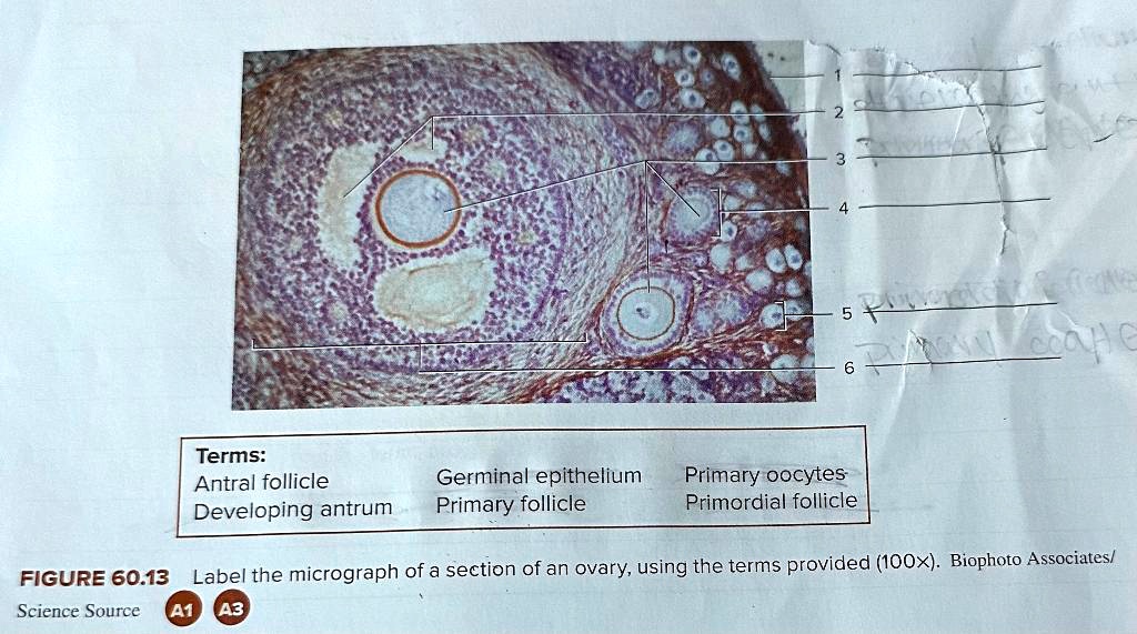 terms antral follicle developing antrum germinalepithelium primary ...