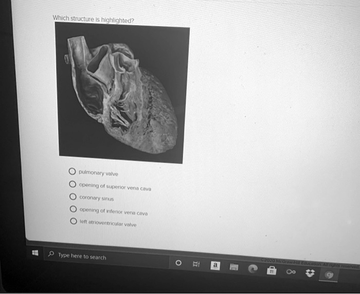 Which structure is highlighted? ? pulmonary valve ? opening...