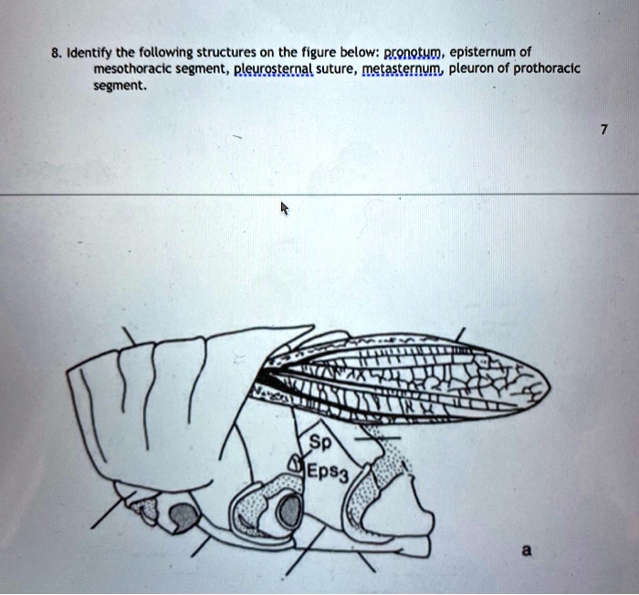 SOLVED: 8. Identify the following structures on the figure below ...