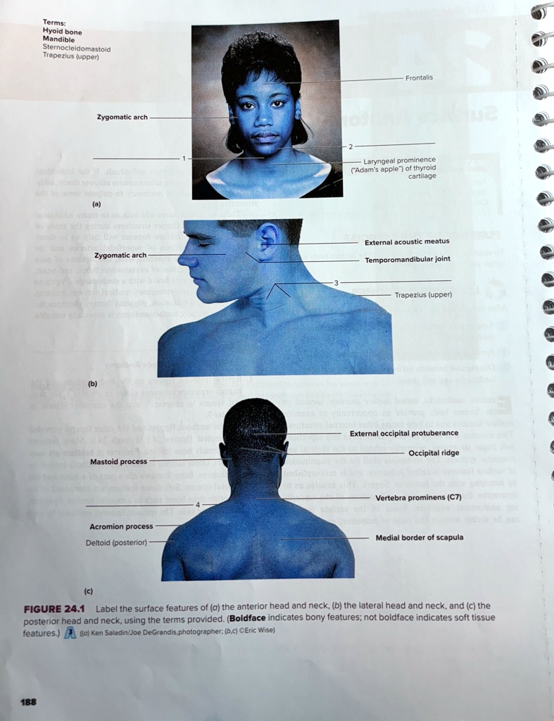 Terms: Hyoid bone Mandible Sternocleidomastoid Trapezius (upper ...