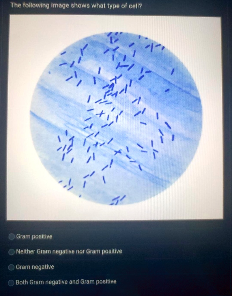SOLVED: The following image shows what type of cell? Gram positive ...
