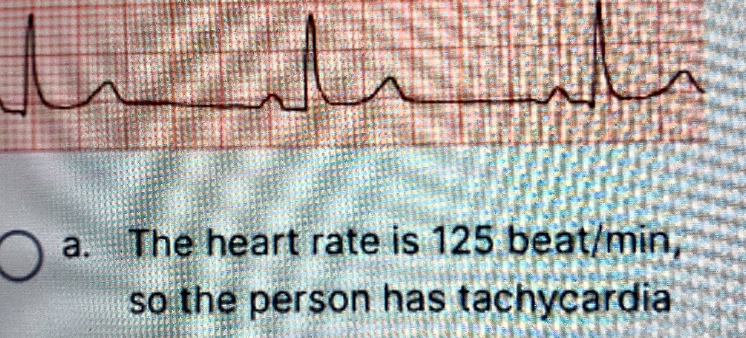 a. The heart rate is 125 beat/min, so the person has tachycardia