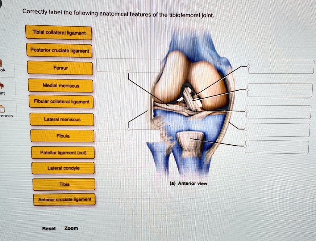 Correctly label the following anatomical features of the tibiofemoral ...