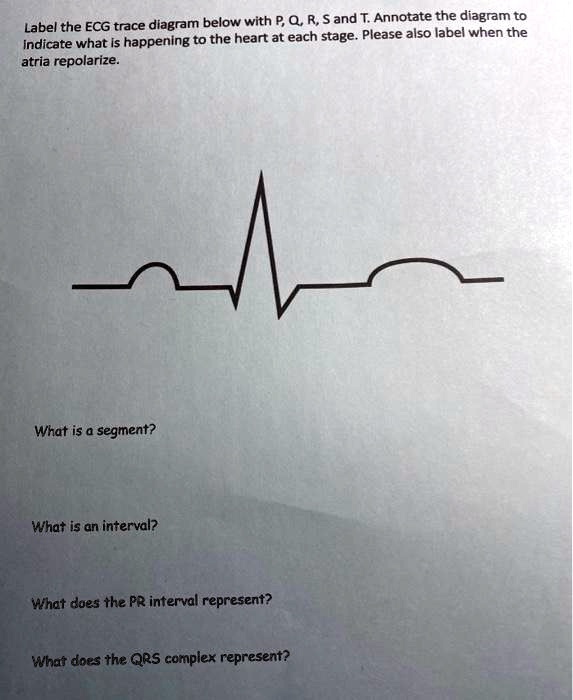 SOLVED: Texts: Label the ECG trace diagram below with P, QRS, and T. Annotate the diagram to ...