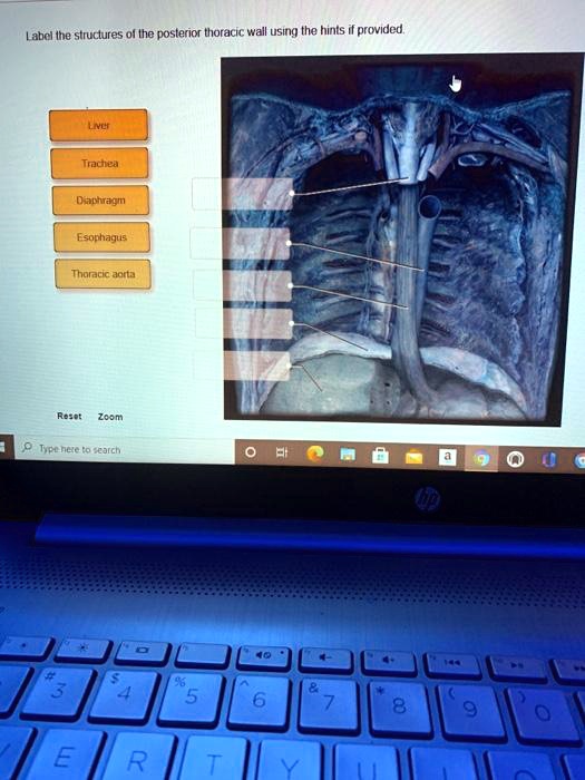 Label the structures of the posterior thoracic wall using the hints if provided. Liver Trachea ...