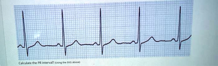 Calculate the PR interval? (using the EKG above)
