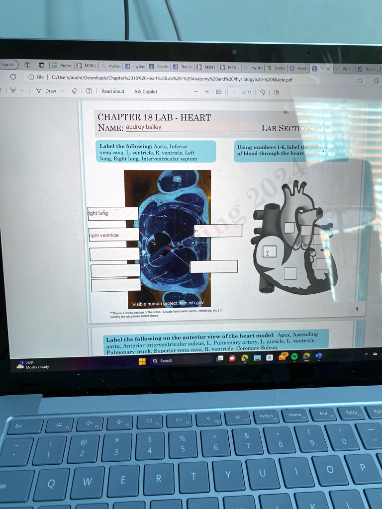Label the following: Aorta, Inferior vena cava, Left ventricle, Right ...