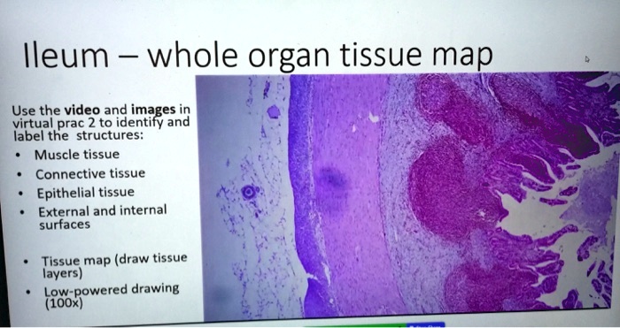 ileum whole organ tissue map use the video and rdentayer virtual prac 2 ...