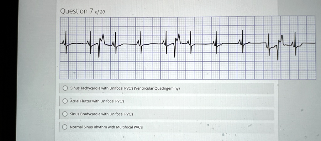question 7 of 20 sinus tachycardia with unifocal pvcs ventricular ...
