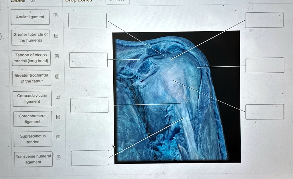 anular ligament greater tubercle of the humerus tendon of biceps ...