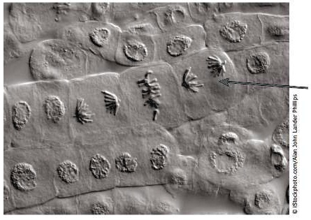 SOLVED: A photomicrograph of onion root tip cells during mitosis is ...