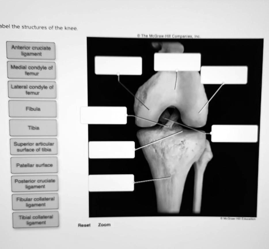 Label the structures of the knee. The McGraw-Hill Companies, Inc ...