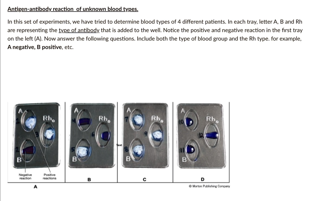 SOLVED: what is the blood type in patient A? 2. what is the blood type in patient B? 3. what is ...